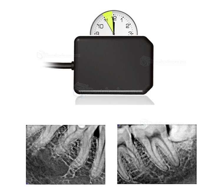 Alta calidad Handy HDR 500 sensores intraorales rayos x radiologia ...